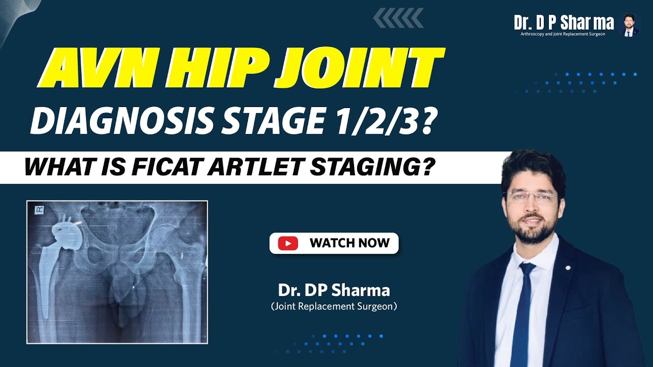 Diagnosis of AVN Hip X-ray/MRI Stage 1/2/3? Ficat and Artlet ...