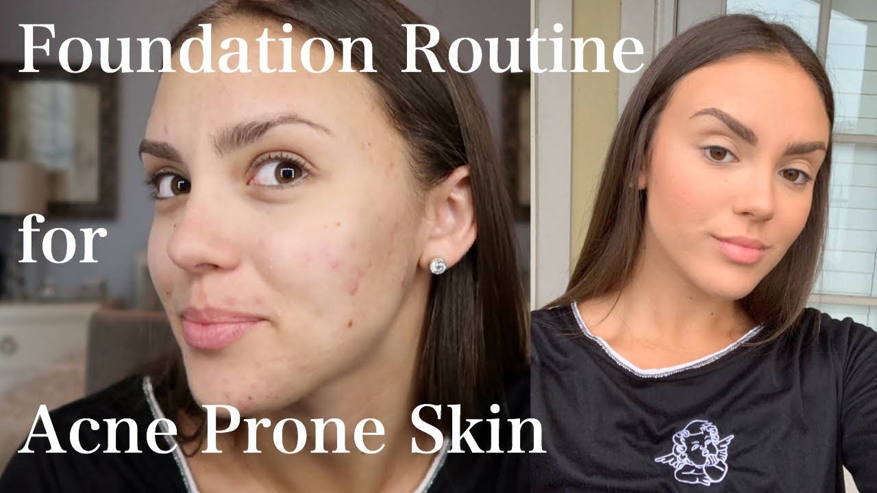 My Flawless Base Routine Covering Acne Youtube