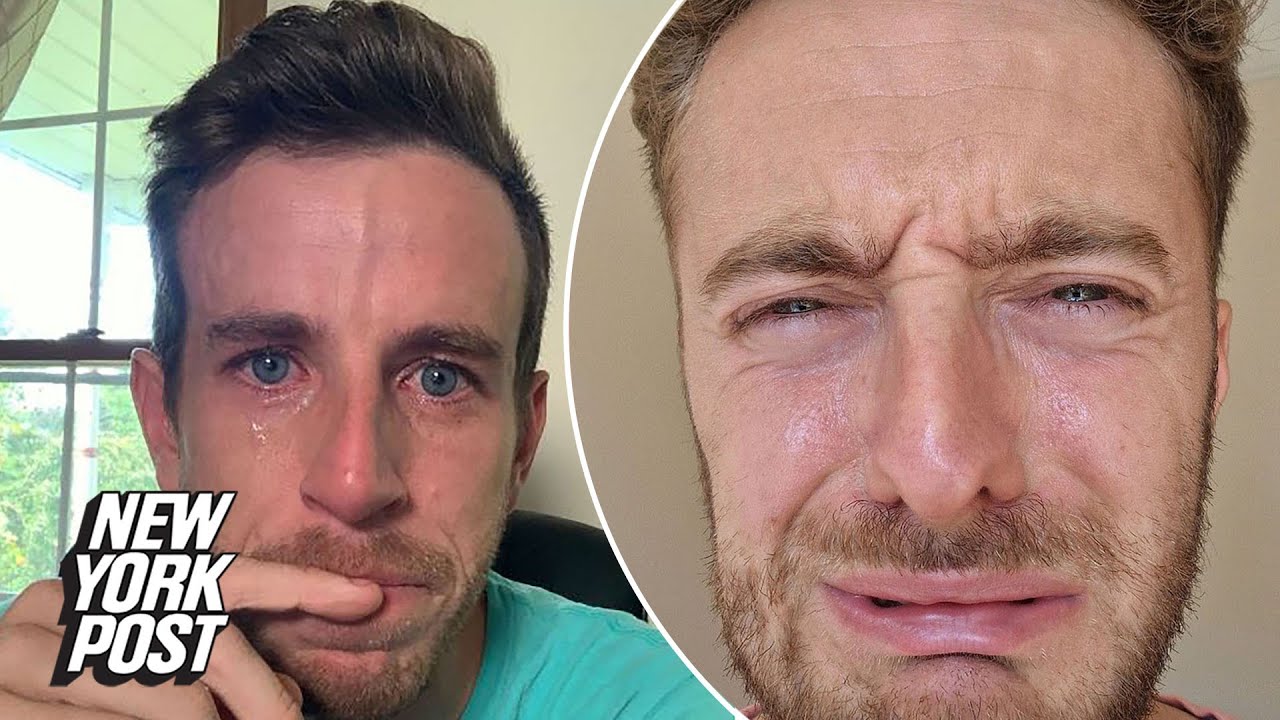 LinkedIn users mock ‘crying selfie’ CEO who fired workers | New York ...