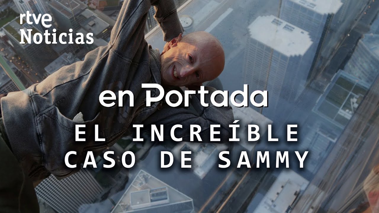 EN PORTADA - "EL INCREÍBLE CASO DE SAMMY", la VIDA de un PACIENTE de ...