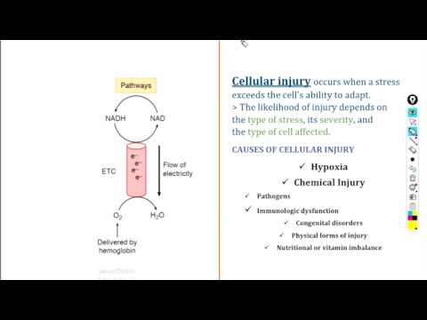 Cellular Injury Types Causes 1/ MBBS Pathology Pathoma USMLE KMU UHS ...