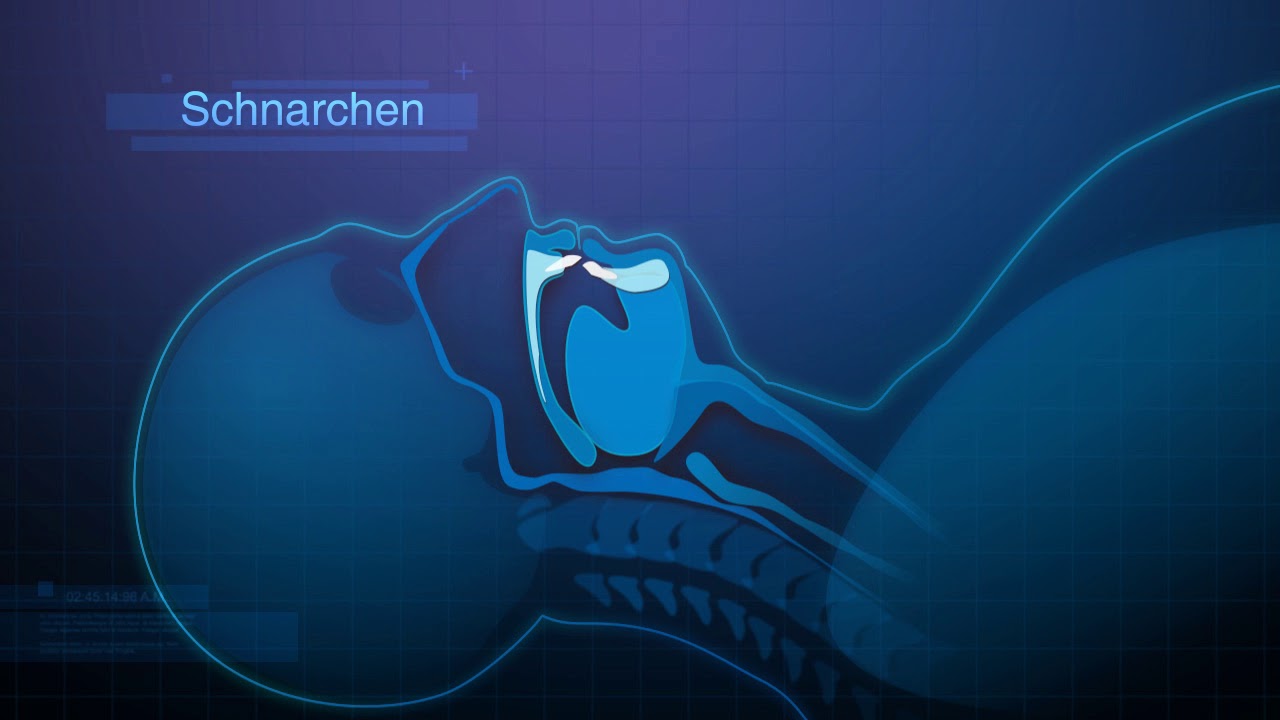 Wie entsteht Schnarchen? - YouTube