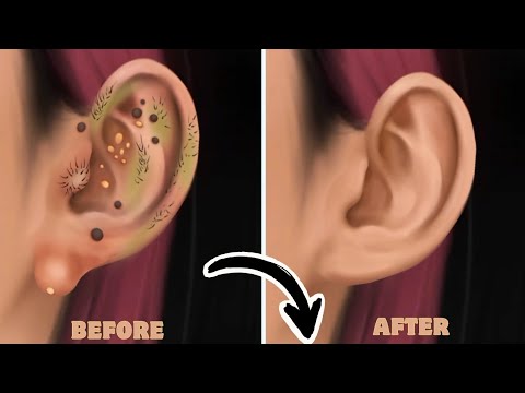 ASMR Ear Treatment & Cleaning animation #asmr #animation - YouTube