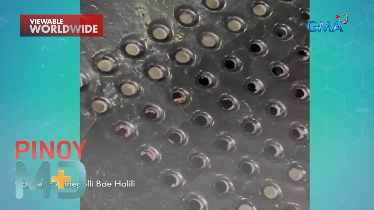 Bed bugs o surot, paano nga ba mapupuksa? | Pinoy MD - YouTube