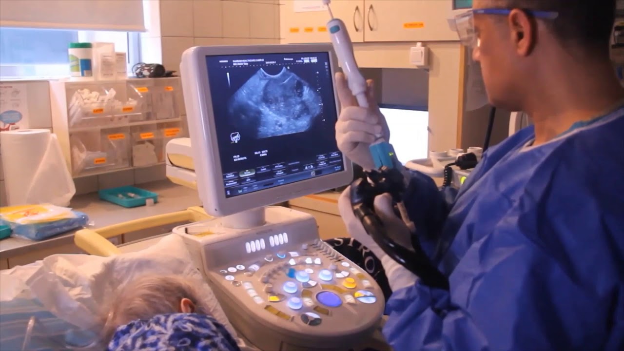 Iyad Khamaysi. Limaca EUS FNB procedure - YouTube