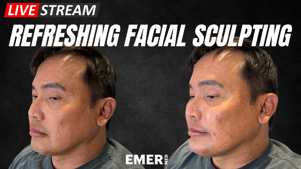 MALE FACIAL SCULPTING TO REFRESH | Dr. Jason Emer - YouTube