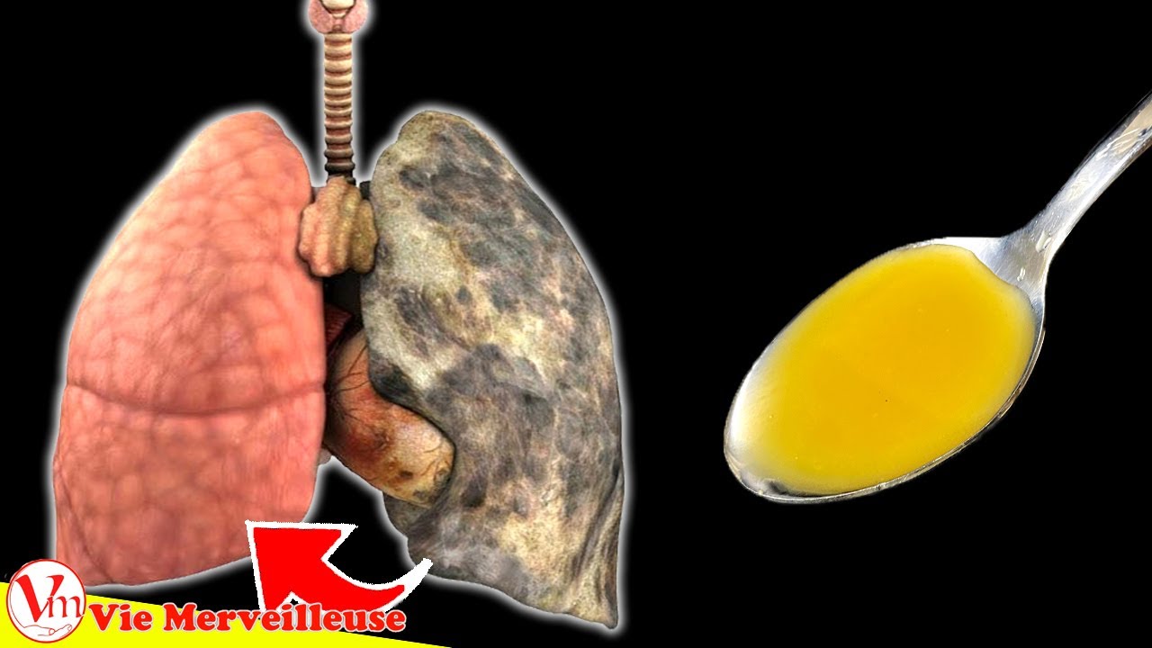 1 Seule Cuillère Par Jour! Éliminer Le Mucus De La Gorge Et Renforcez ...