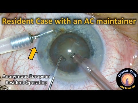 use of an Anterior Chamber Maintainer during Cataract Surgery (AC ...