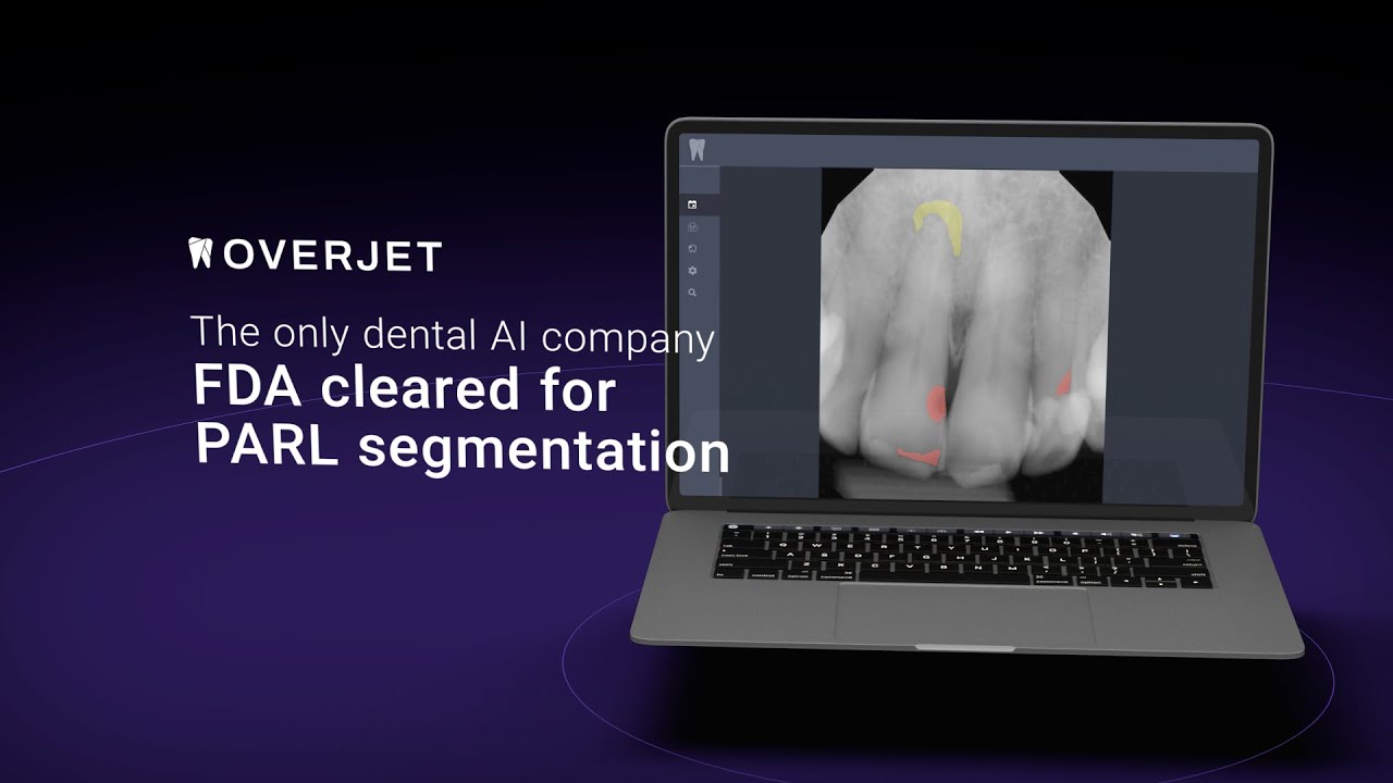 First-of-its-kind, FDA-cleared PARL segmentation capabilities - YouTube