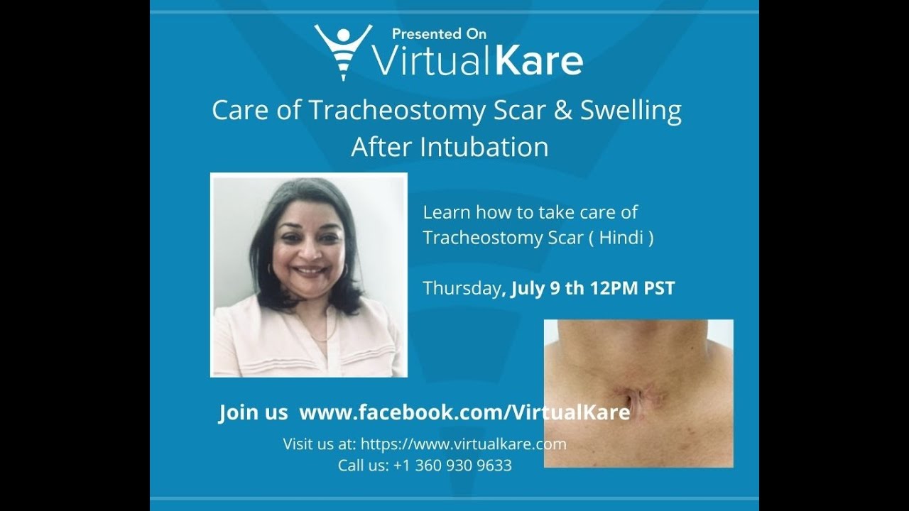 Care of Tracheostomy Scar & Swelling After Intubation Hindi with Shaloo ...