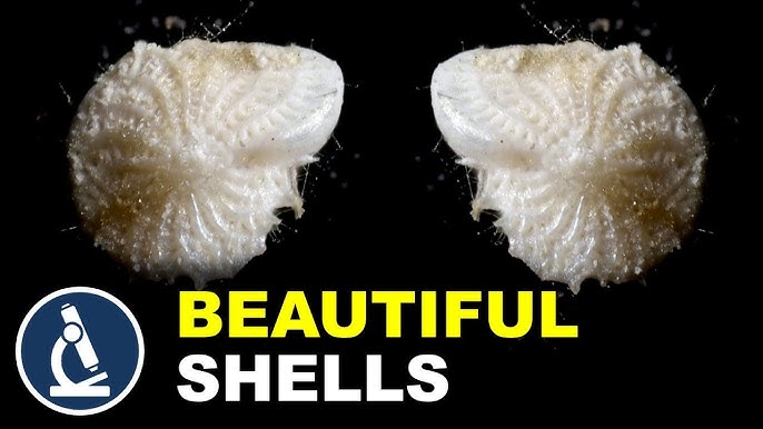 Foraminifera Under Microscope