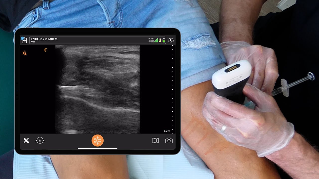 Hyaluronic Acid Knee Injection - YouTube