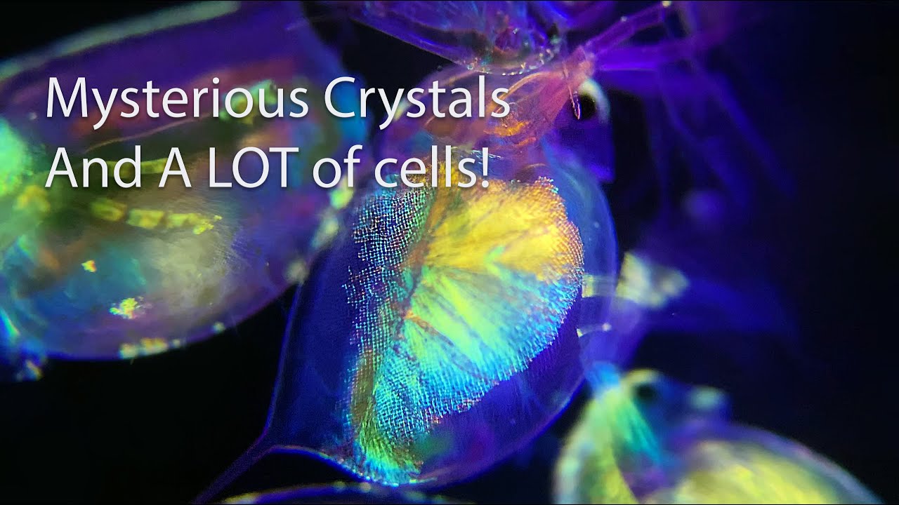 Different Single Celled Organisms And More - Under The Microscope - YouTube