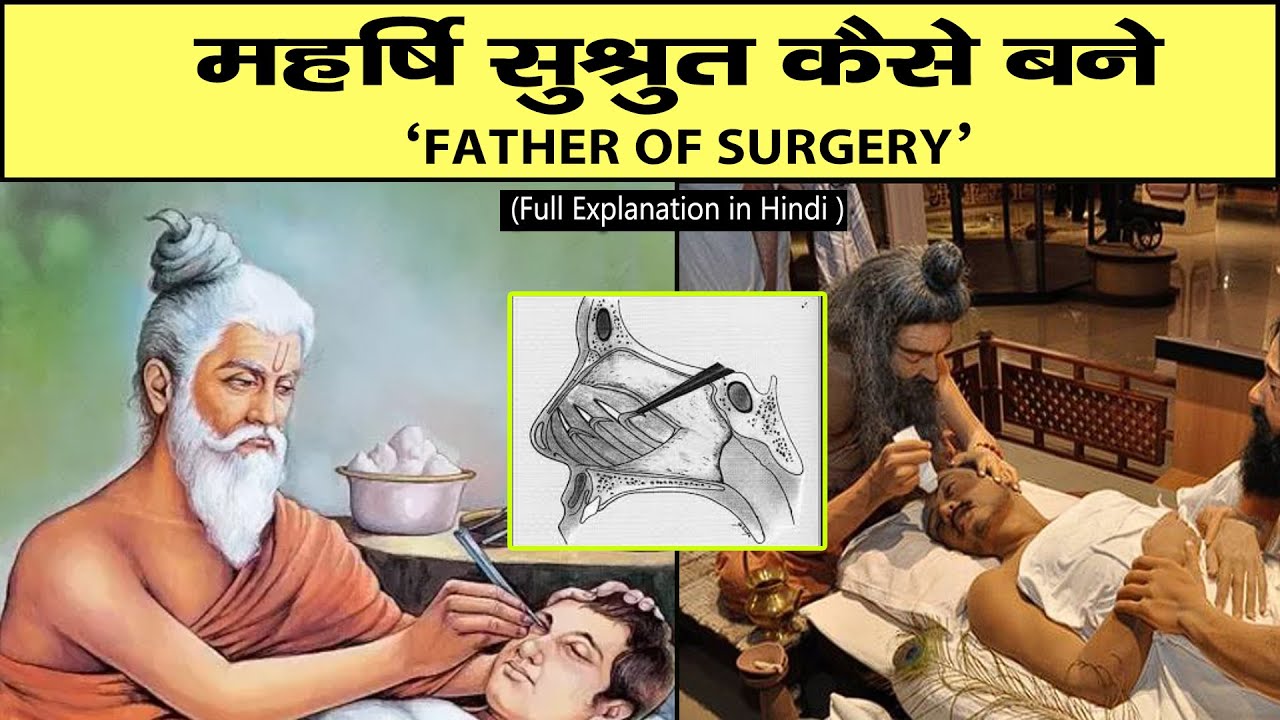 तो ऐसे होती थी 3 हजार साल पहले Plastic Surgery | Father of Surgery ...