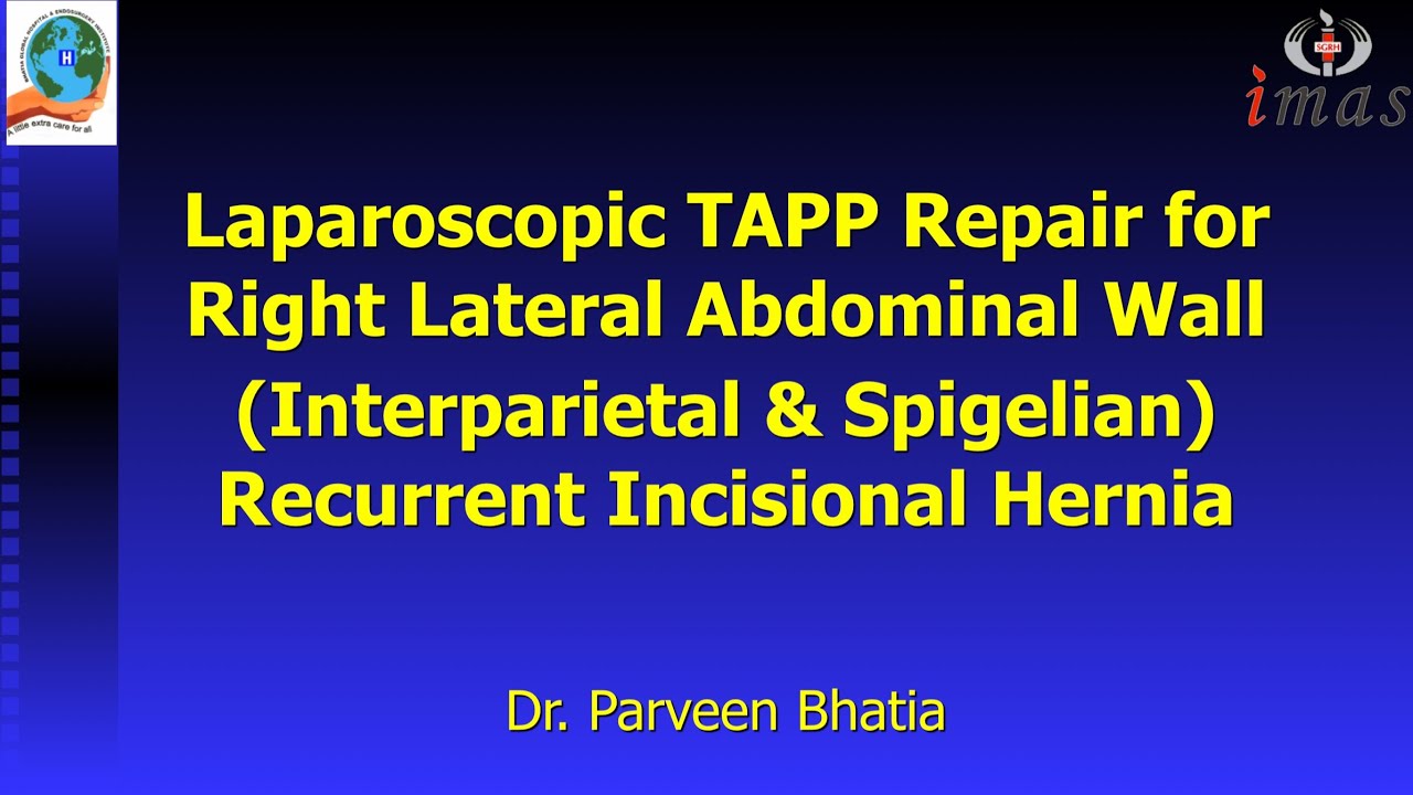 Laparoscopic TAPP repair for Right Lateral Recurrent Incisional Hernia ...