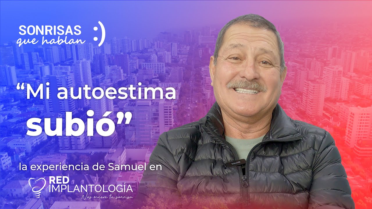 Sonrisas Que Hablan 😄🦷 #05 La experiencia de Samuel - Red Implantología ...