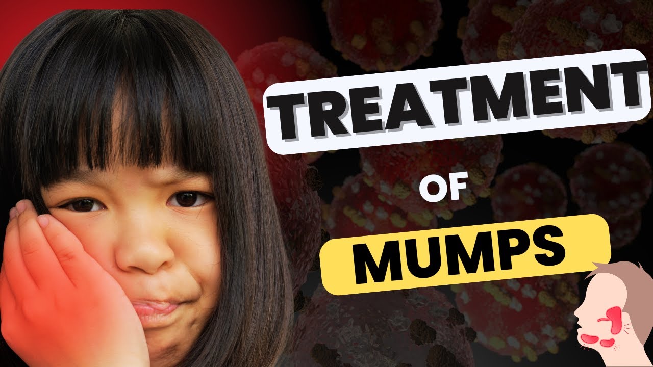How to Cure Mumps Fast: Top Treatments & Secrets You Need to Know! | By ...