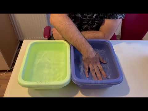 elde soğuk sıcak kontrast banyo #elfiziktedavi