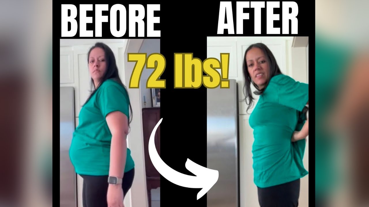 Zepbound Before & After- How I Lost 72 lbs - YouTube