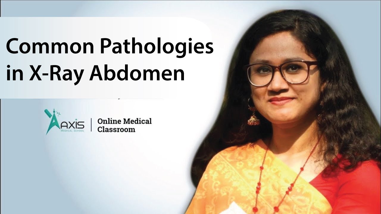 Radiology & Imaging | Class 7 | Common Pathologies in X-Ray Abdomen ...