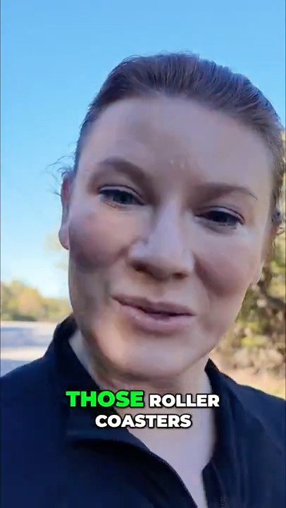 Big Forehead Problems: Hairline Lowering Could Change Your Life! - YouTube