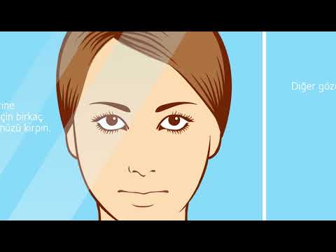 Günlük Lens Takma İşlemi