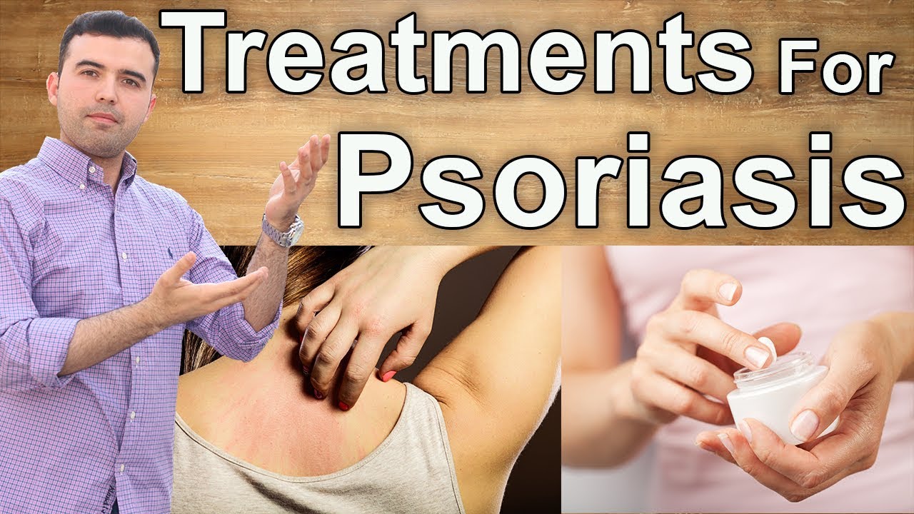 Get Rid of Psoriasis! – Natural Cures to Treat Psoriasis Permanently ...