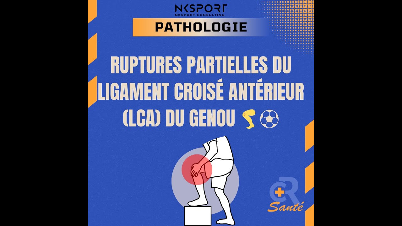 Rupture Partielle du LCA : Comprendre, Diagnostiquer et Traiter #LCA # ...