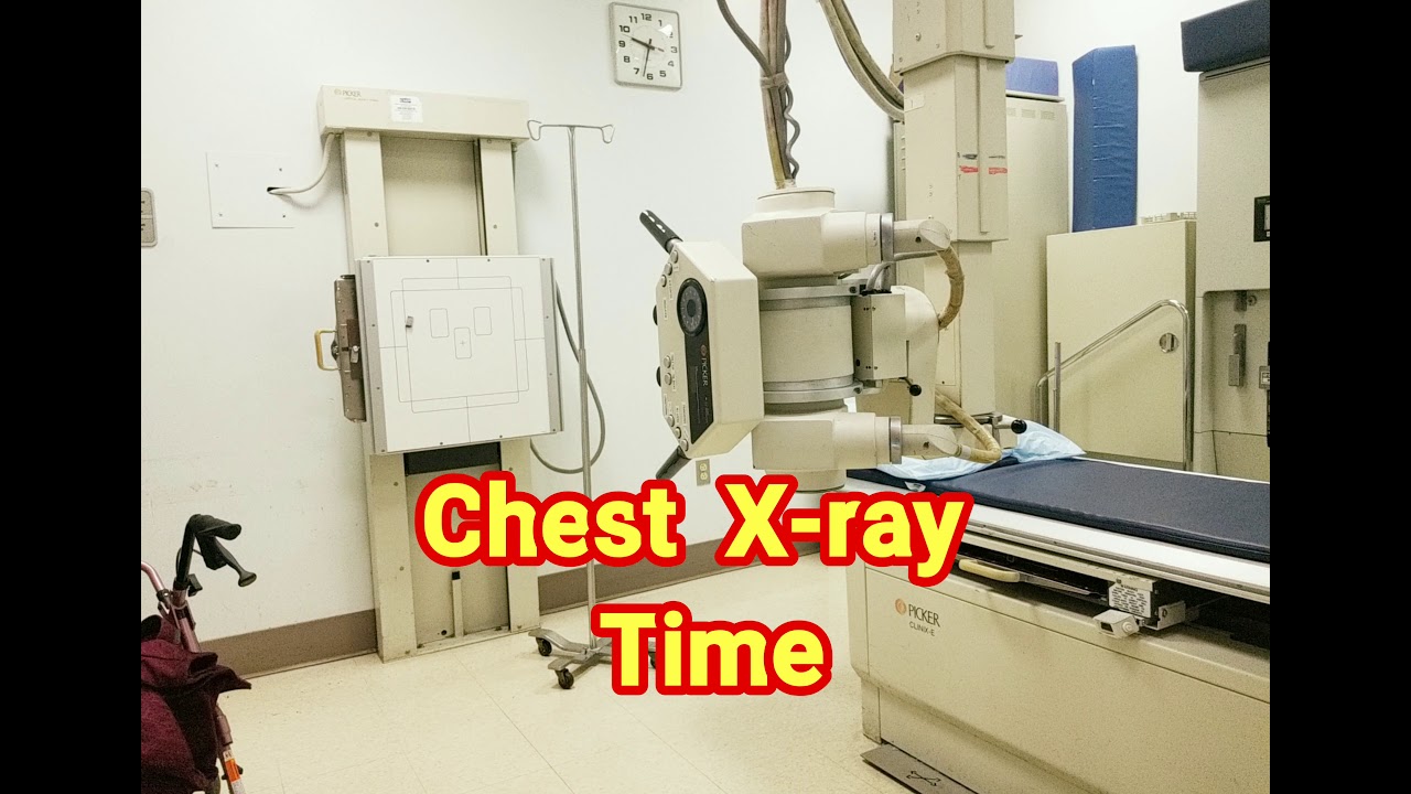 Physical Therapy & Chest X-Ray - YouTube