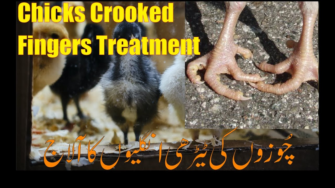 Chzon Ki Terhi Ungliyon Ka Ilaj Chicks Crooked Finger Treatment In Urdu Hindi YouTube chzon-ki-terhi-ungliyon-ka-ilaj-chicks-crooked-finger-treatment-in-urdu-hindi-youtube