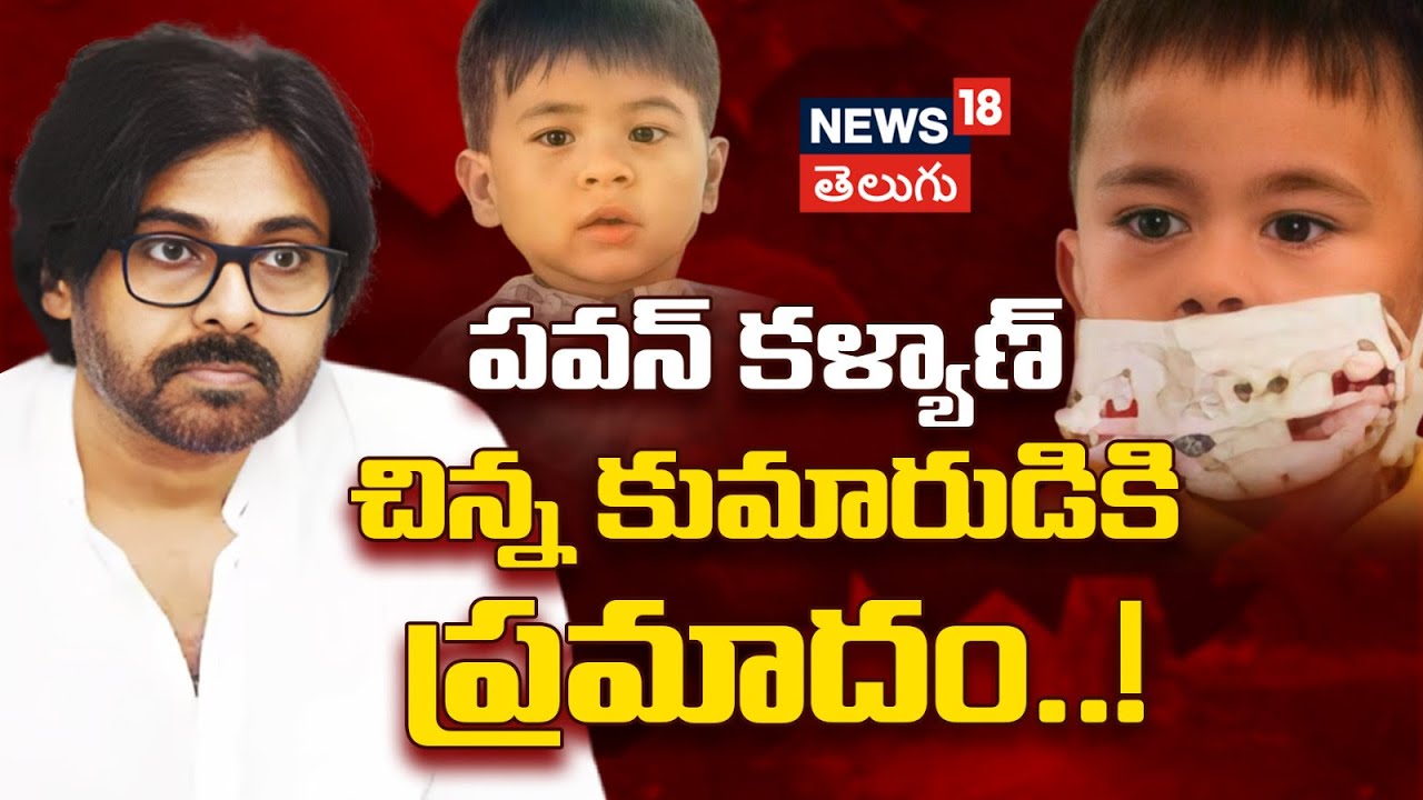 Pawan Kalyan's Son Mark Shankar injured | Singapore | పవన్ కళ్యాణ్ ...
