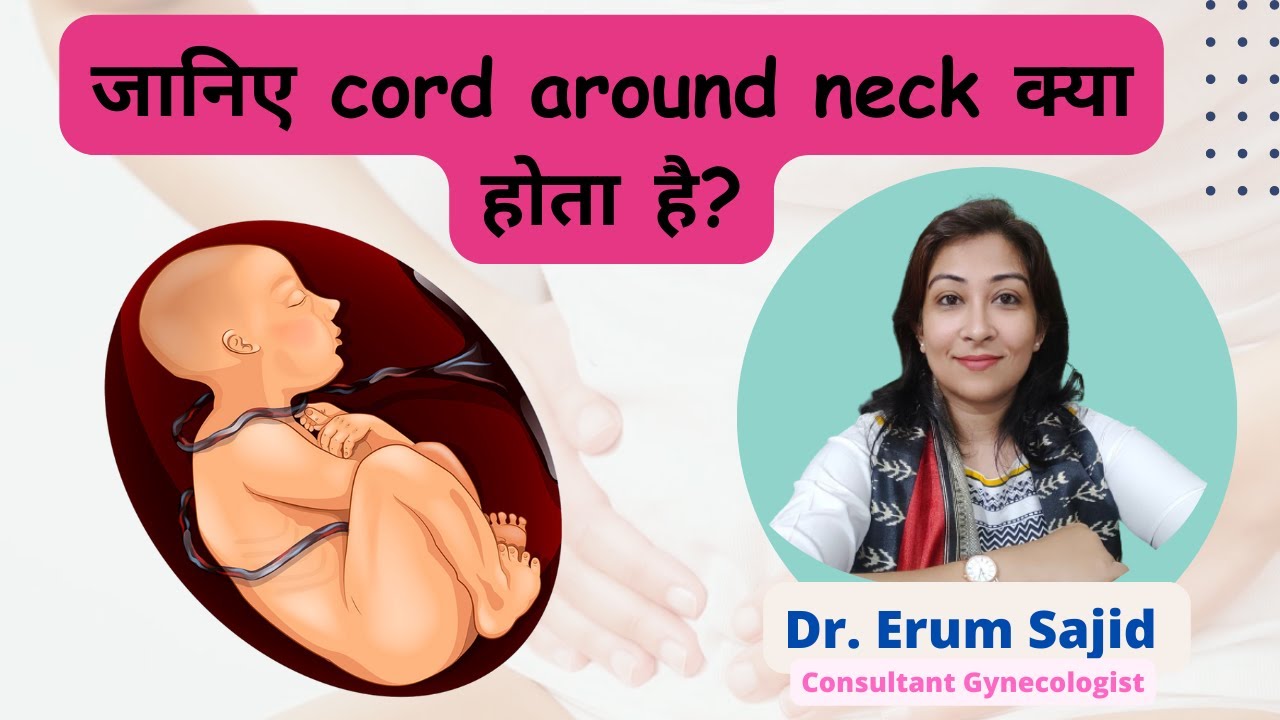 Cord Around Neck?|Dr Erum Hassan Clinic Best Gynaecologist Patna, Bihar ...