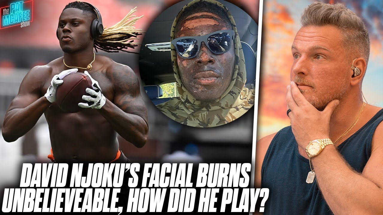 David Njoku Showed Off Face Burns, Unreal He Played 2 Days Later | Pat ...