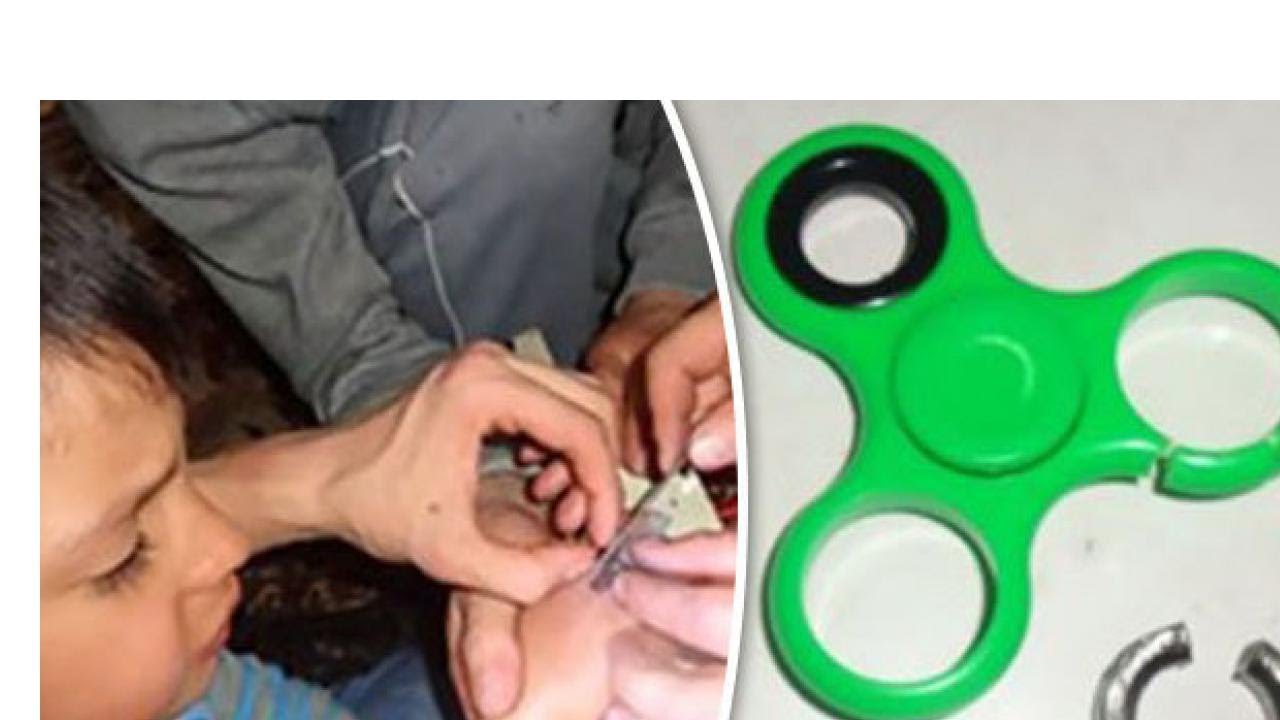 Little lad almost loses finger in fidget spinner horror - YouTube