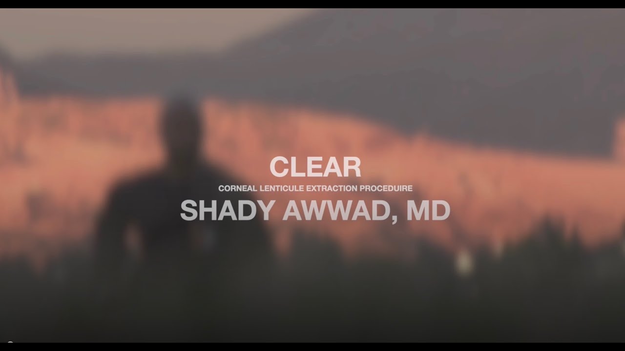 Step-by-step guide to Ziemer's CLEAR lenticule extraction by Shady ...