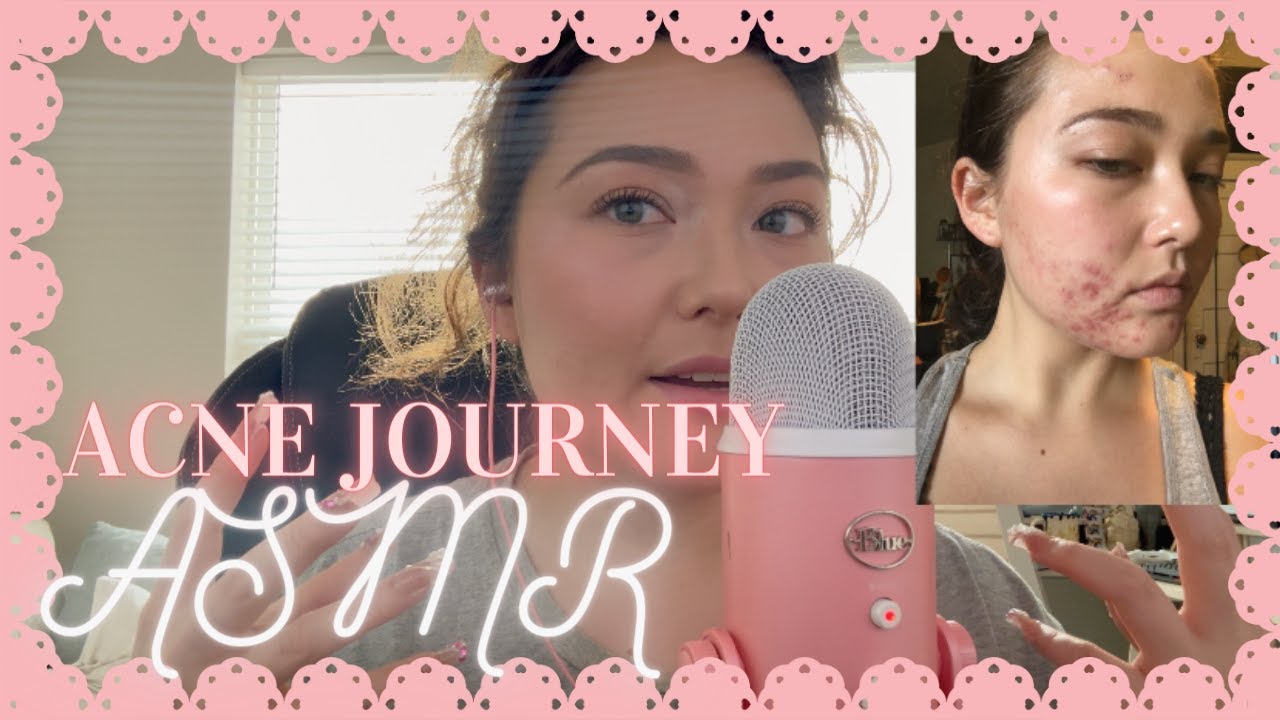 Let's Talk Acne | ASMR by Rowan - YouTube