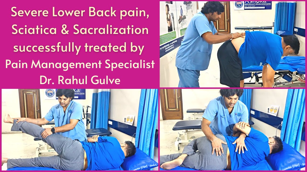 Low Back pain, Sciatica, Sacralization treatment | Pain Management ...