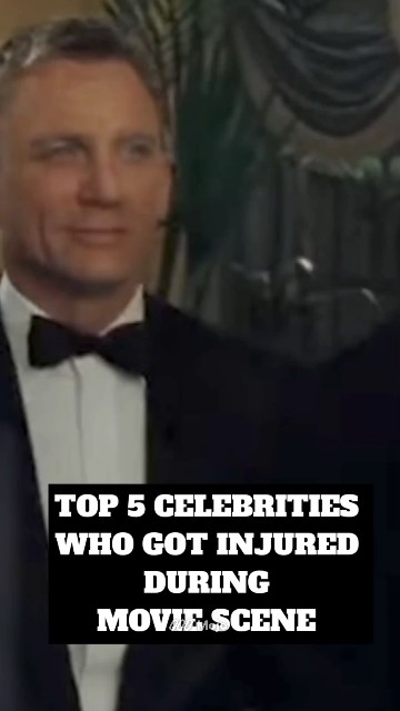TOP 5 CELEBRITIES WHO GOT SERIOUSLY INJURED DURING MOVIE SCENES # ...