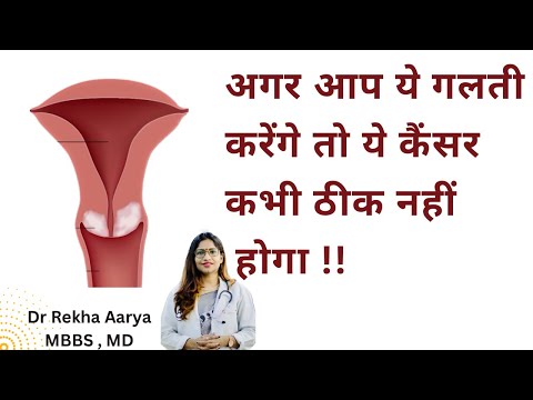 Brachytherapy for Carcinoma Cervix ( सर्वाइकल कैंसर या बच्चेदानी के मुंह का कैंसर )
