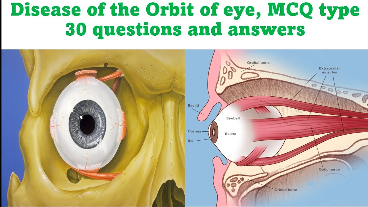 MCQ type questions and answers of the Orbit of eye , very most ...