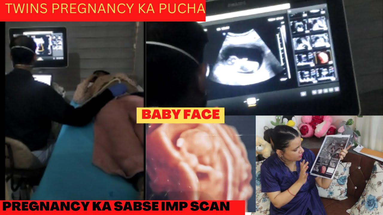 🤰Pregnancy Ki Sabse Imp Sonography/NT SCAN||Twins Pregnancy Ka Pucha ...