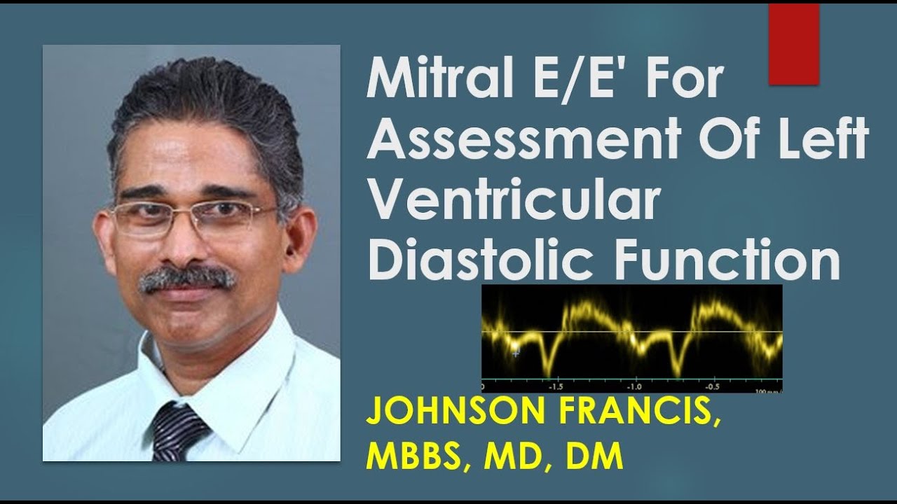 Mitral E/E' For Assessment Of Left Ventricular Diastolic Function - YouTube