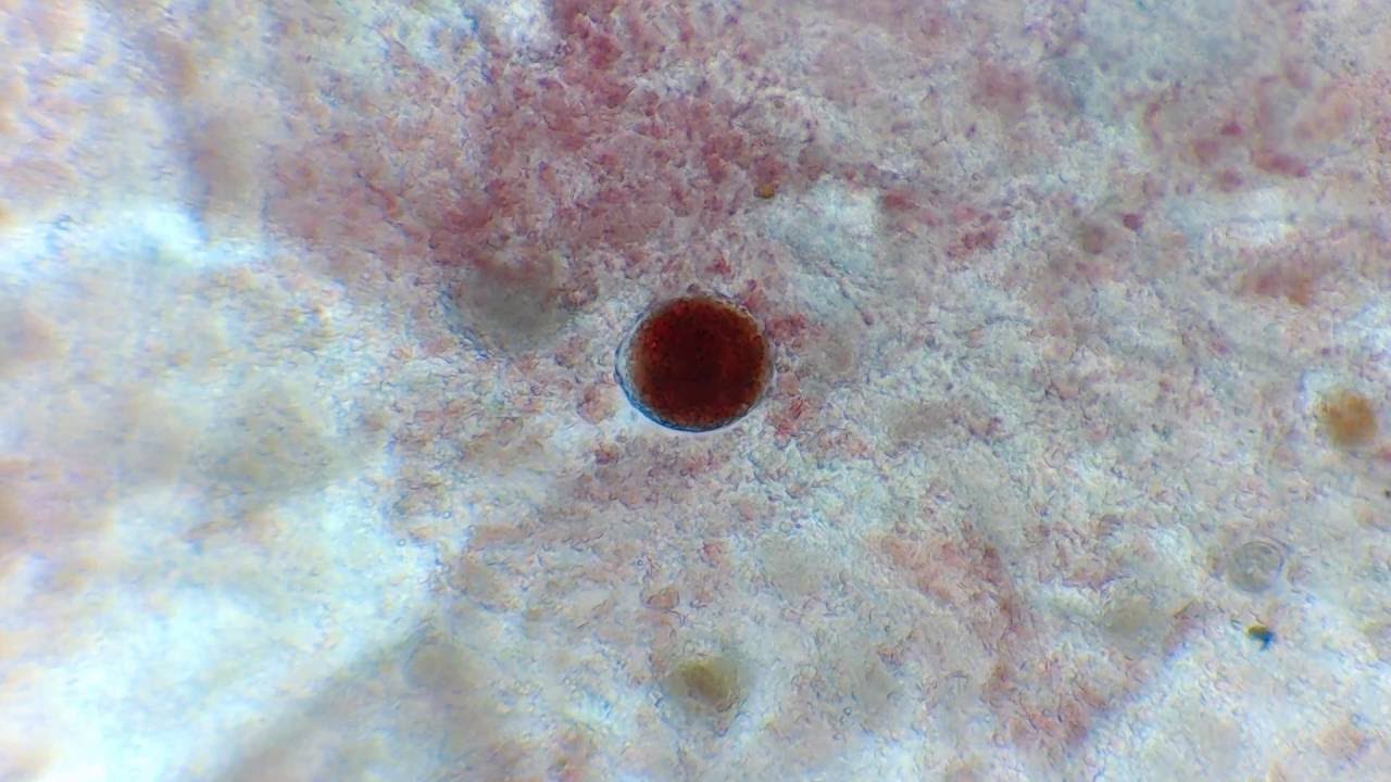 Cryptocaryon - YouTube