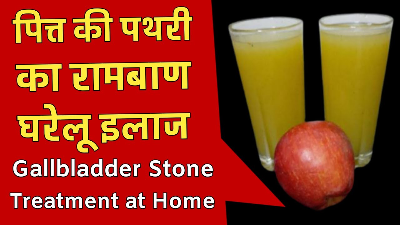 पित्ताशय की पथरी का रामबाण घरेलू इलाज | Home Remedy For Gallbladder ...