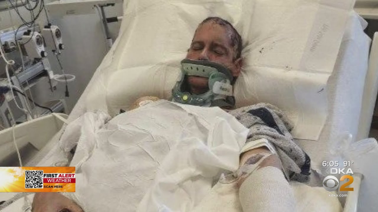 Man attacked with brick in New Kensington - YouTube