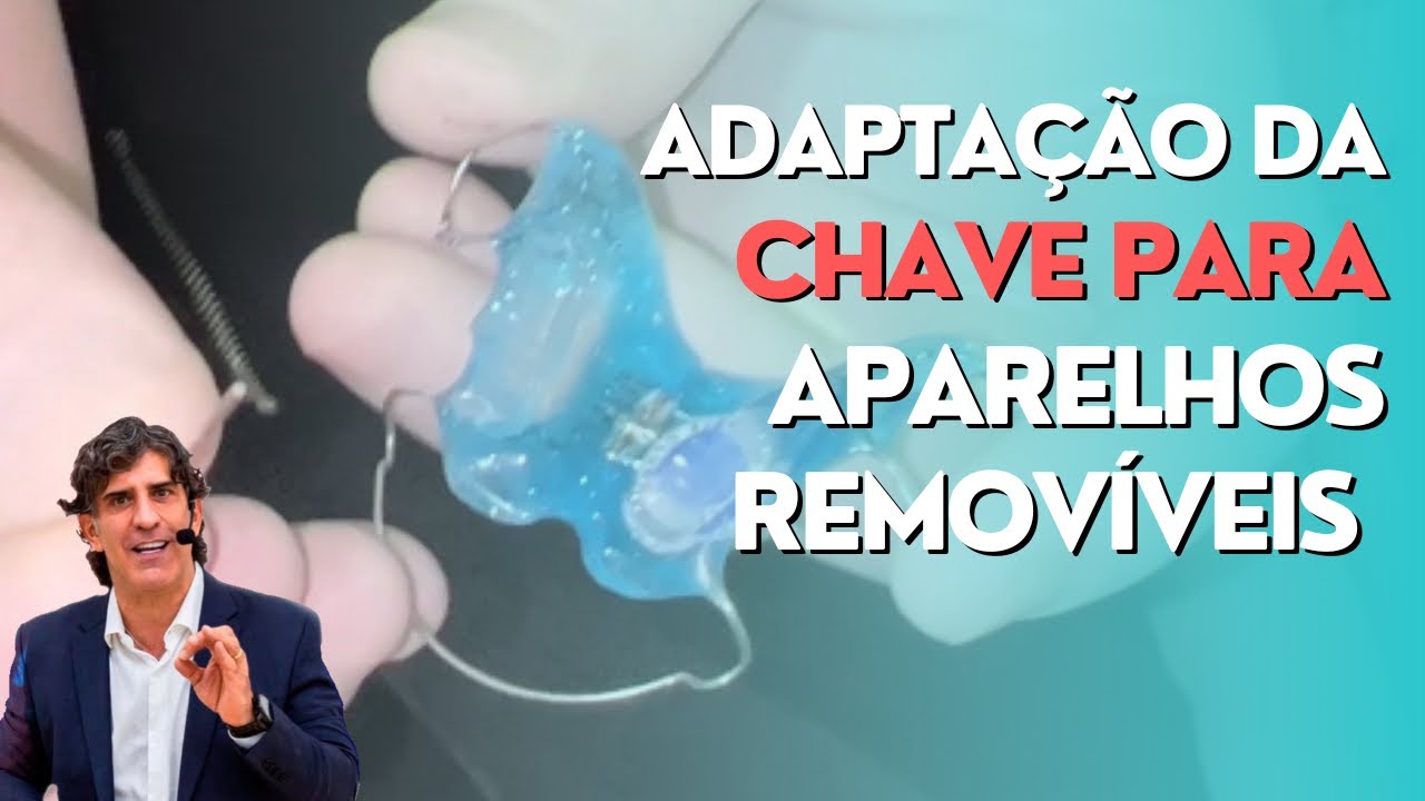Adaptação da chave para aparelhos removíveis - YouTube