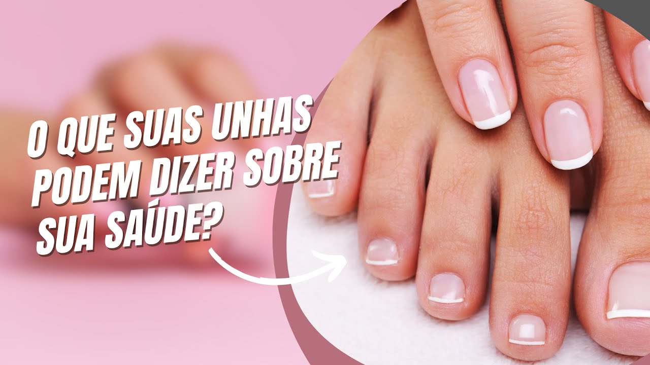 O QUE SUAS UNHAS DIZEM SOBRE SUA SAÚDE? - YouTube