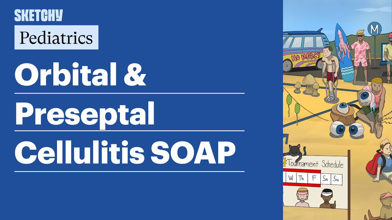 Orbital & Preseptal Cellulitis SOAP (Pediatrics) | Sketchy Medical ...