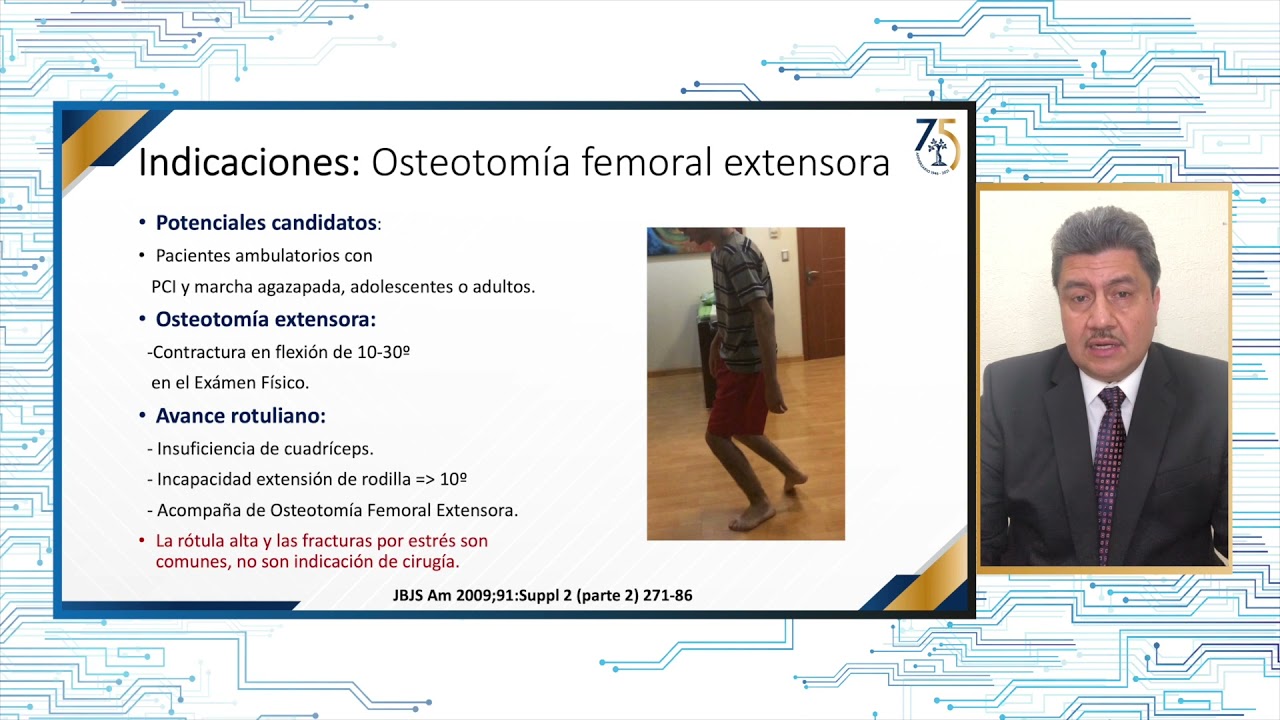 Marcha agazapada oteotomía extensora/descenso rotuliano - YouTube