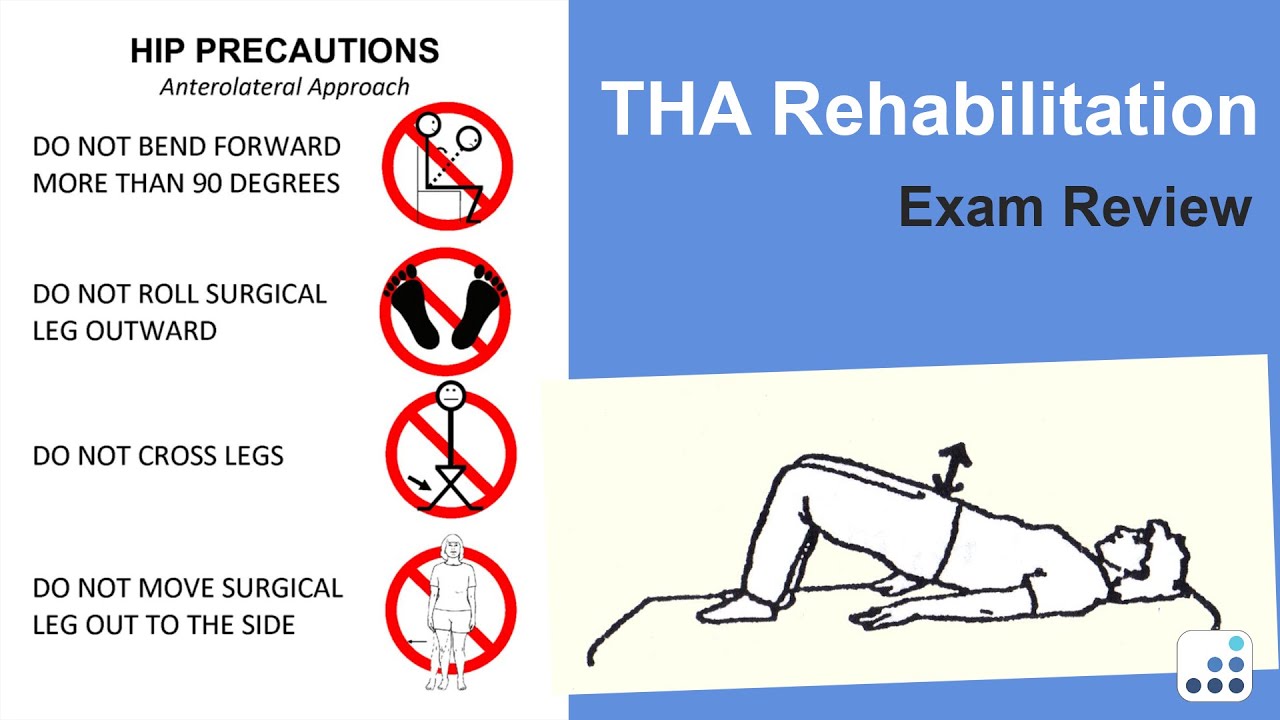 THA Rehabilitation Exam Review - Doug Padgett, MD - YouTube